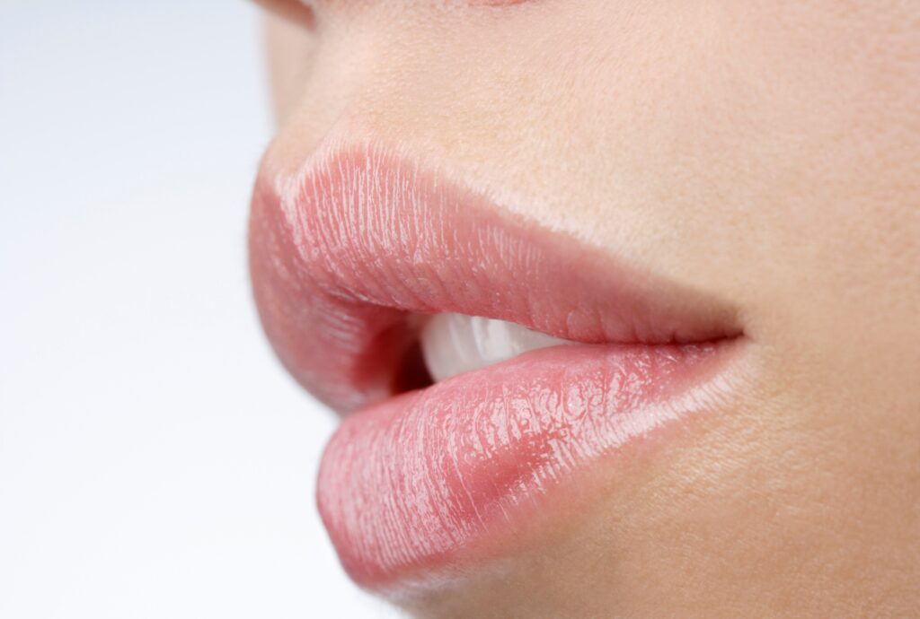 Acide hyaluronique lèvres | Dr Tribout | Dermatologie esthétique | Amiens