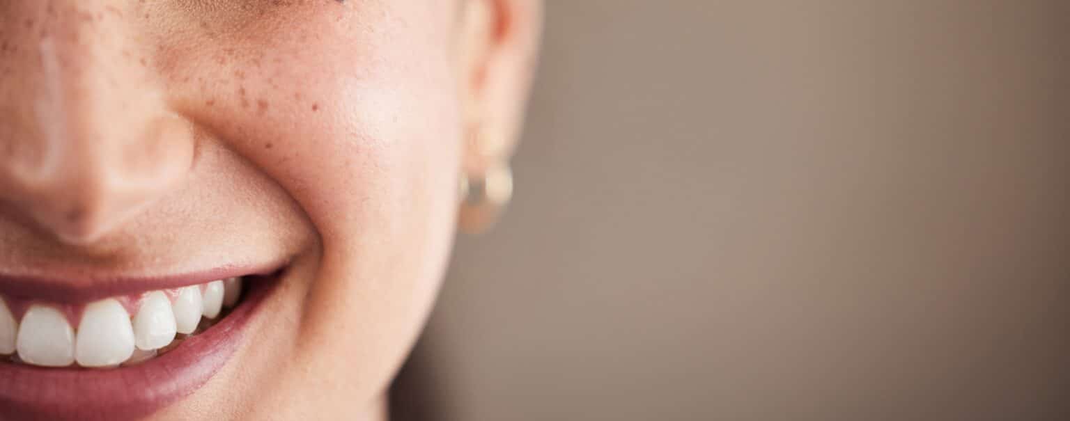 Comment corriger un sourire asymétrique ? | Dr Tribout | Amiens